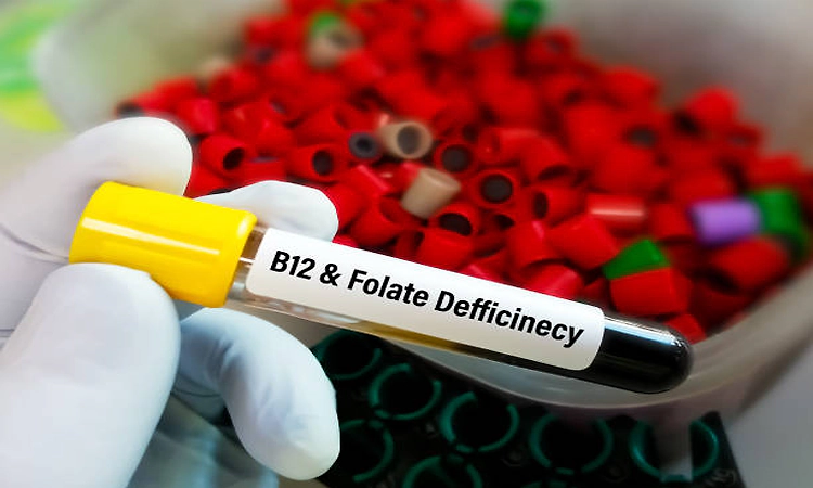 Vitamin B12, folate deficiencies could be related with fatigue, reduced ...